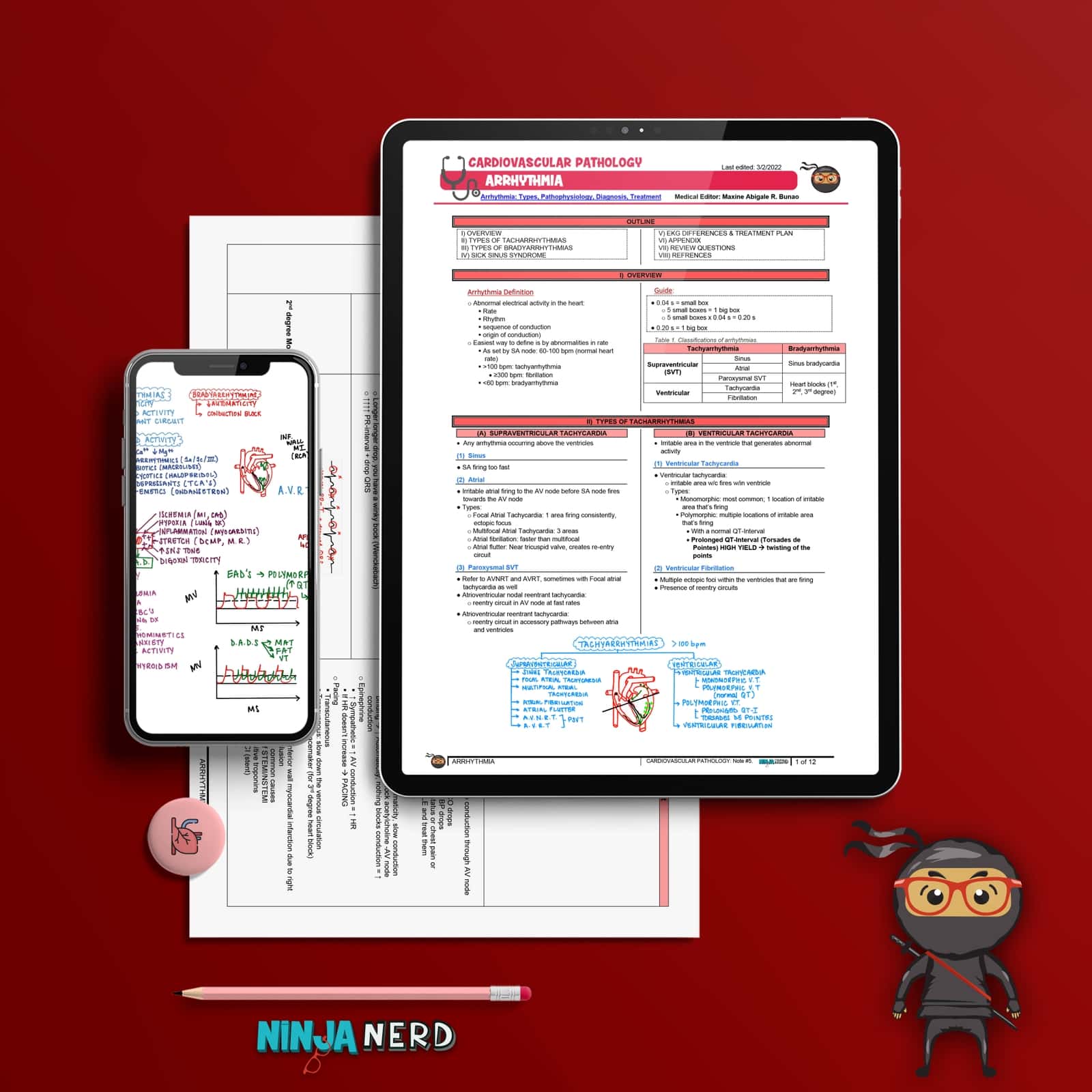Arrhythmias | Types, Pathophysiology, Diagnosis, Treatment ...